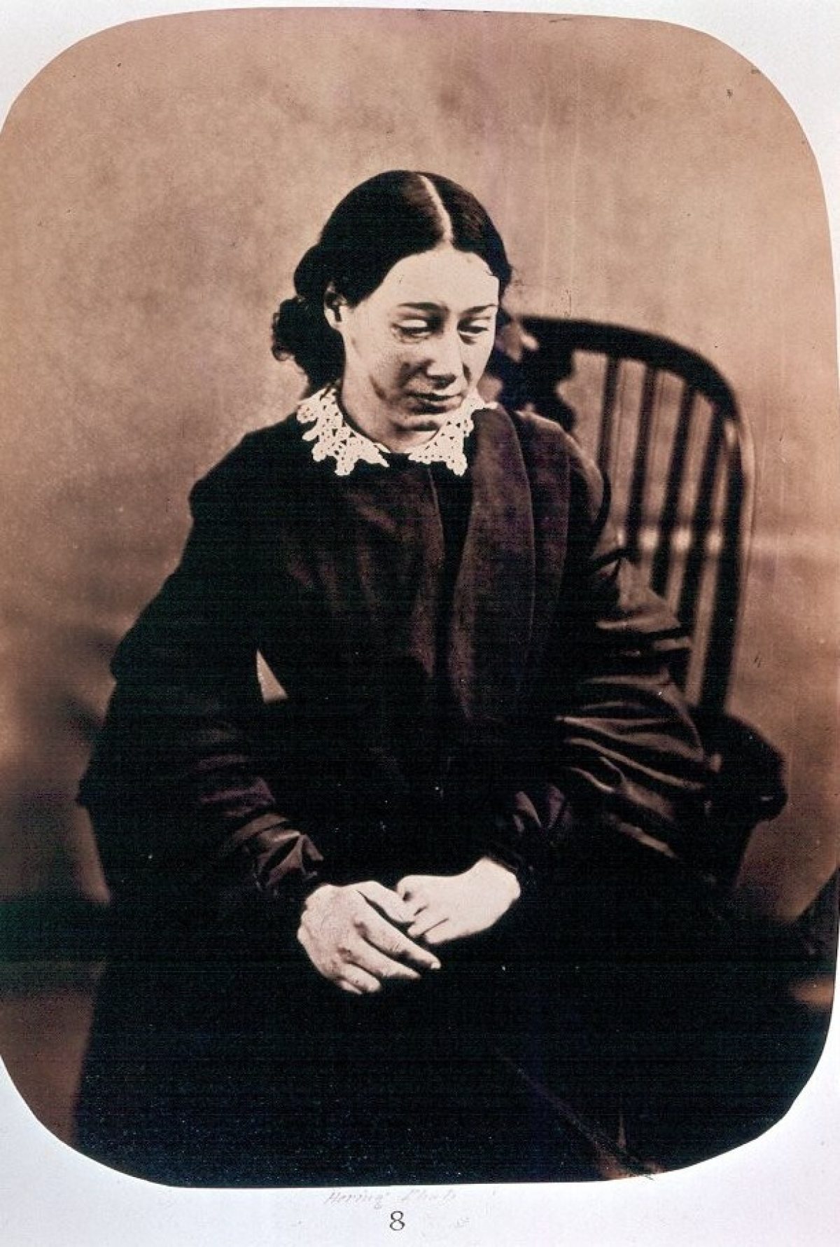 Hospital Snapshots 1 | Bethlem Museum of the Mind